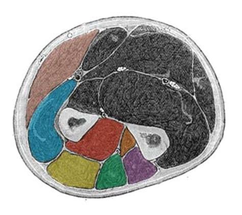 Anatomy Proximal Mid Forearm Cross Section Rue Supinated Head On