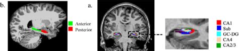 Example Segmentation Of A Hippocampal Subregions And B Subfields From
