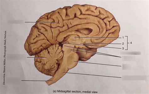 The Brain Midsagittal Section Median View Diagram Quizlet