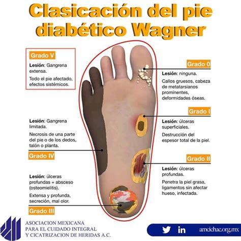 Dr Feet Podologia Clinica On Tumblr