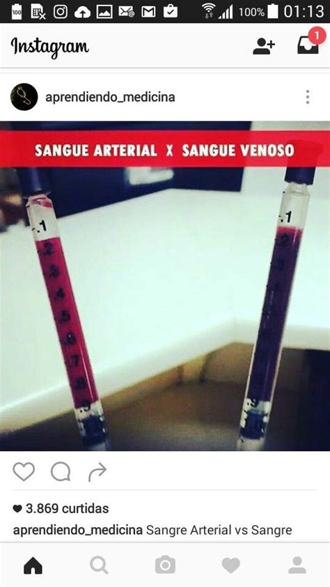 Sangue arterial e sangue venoso diferença Medicina Baseball Bat