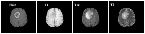 diagnostics free full text deeptumor framework for brain mr image classification