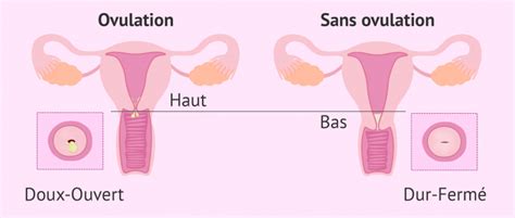 Col de l utérus comment faciliter la dilatation et l effacement