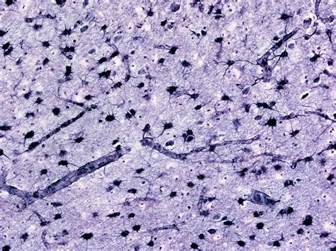 Brain Tissue Light Micrograph Stock Image C024 0106 Science