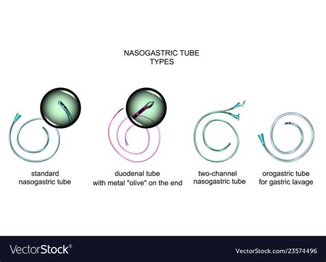 Lanzamiento Disparo Parlamento Types Of Nasogastric Tube Elasticidad