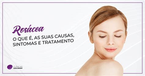 Rosácea O que é as suas causas sintomas e tratamento Clínicas Nuno
