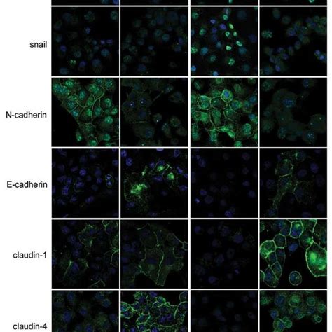 DEC1 expression is upregulated by TGF β in human pancreatic cancer