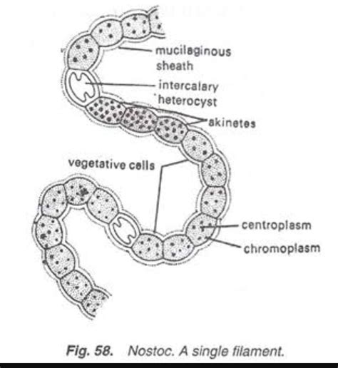 DIAGRAM Skeleton Labeled Diagram Of Well MYDIAGRAM ONLINE
