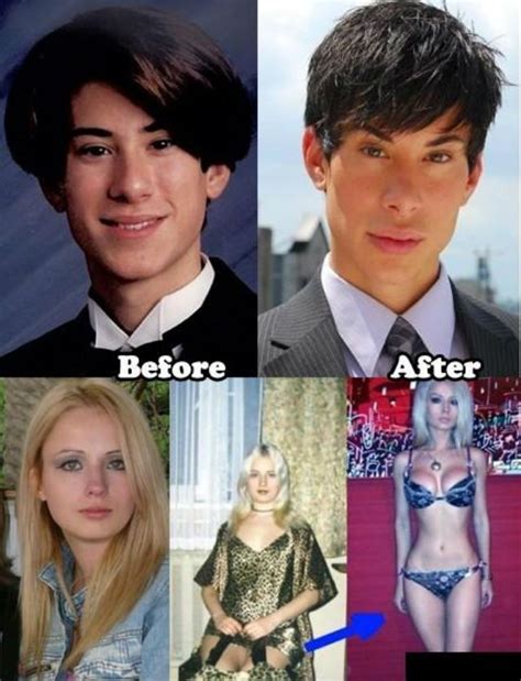 Before And After Plastic Surgery Fail Bad Plastic Surgeries Celebrity