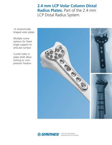 Variable Angle LCP Two Column Volar Distal Radius Synthes 43 OFF