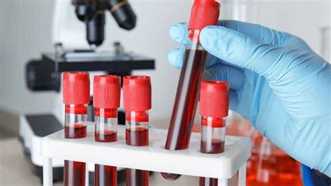 Análises Laboratório Como Interpretar os Resultados