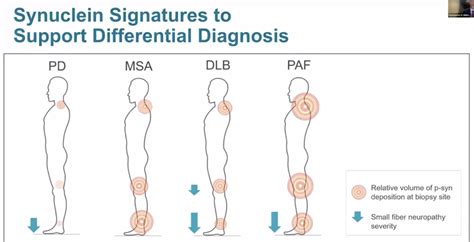 Do I Need A Skin Biopsy Or DaTscan For My Parkinson S Disease