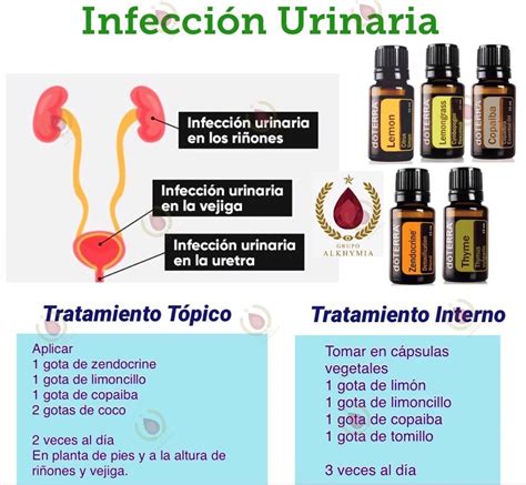 Pin De Rosa Martha Aceves En Doterra Aceites Esenciales Doterra