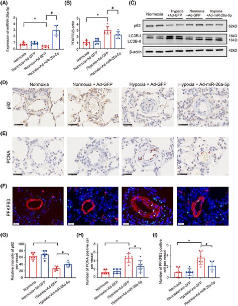The Hif Mir A P Pfkfb Ulk Axis Regulates Vascular Remodeling