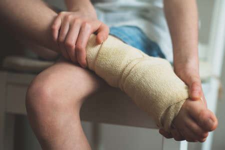 Todo Lo Que Debes Saber Sobre Las Fracturas FisioServ