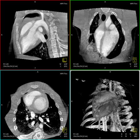 seminar new iterative reconstruction methods in medical imaging [nirm]