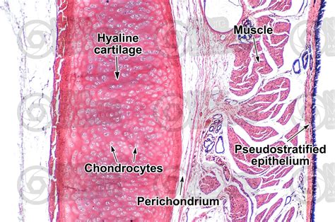 Tracheal Cartilage Histology