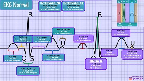CAPÍTULO 11 ELECTROCARDIOGRAMA NORMAL Blog de Julián