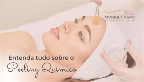 Entenda tudo sobre o PEELING QUÍMICO