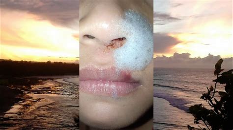 Review Jujur PENYEMBUHAN AMOOREA PADA BISUL DI KAKI Dan LUKA DI BAGIAN
