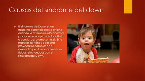 Causas Del Sindrome De Down S Ndrome De Down Cromosomas Cromosoma