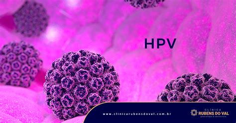 O que é o HPV Clínica Rubens do Val CRM 58764