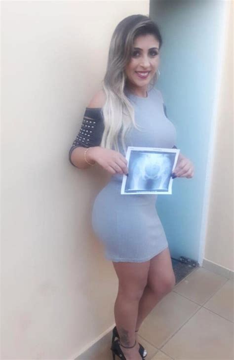 Miss Bumbum 2018 Contestants Pose With X Rays The Advertiser