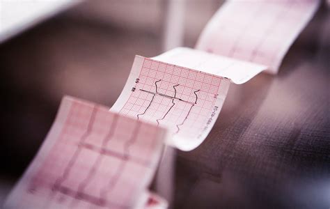 Zapalenie Osierdzia Rodzaje Przyczyny Objawy Skutki Hellozdrowie