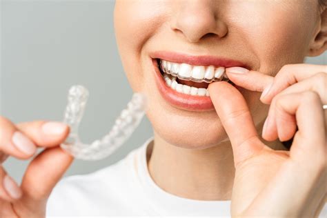 Invisible Braces The Modern Way To Straighten Your Smile In Chandler