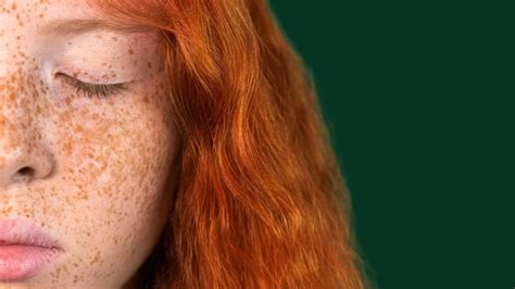 Retrato De Meia Face De Uma Garota Ruiva Muitas Sardas Na Pele E