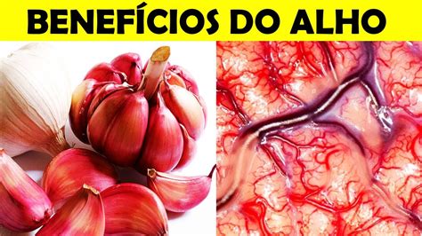 10 Benefícios do Alho Para a Saúde