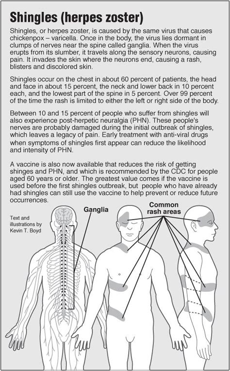 What Does Shingles Look Like On A Black Person What Does