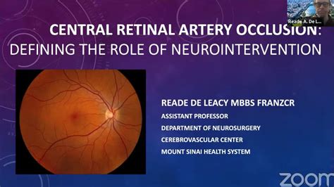 Central Retinal Artery Occlusion Defining The Role Of