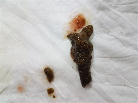 Tipos De FEZES De CACHORRO Como Identificar Problemas
