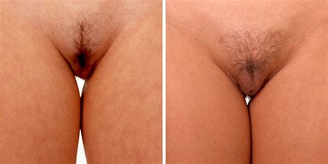 Vulva Galerie Schau Welche Unterschiede Es Gibt Vulva Galerie