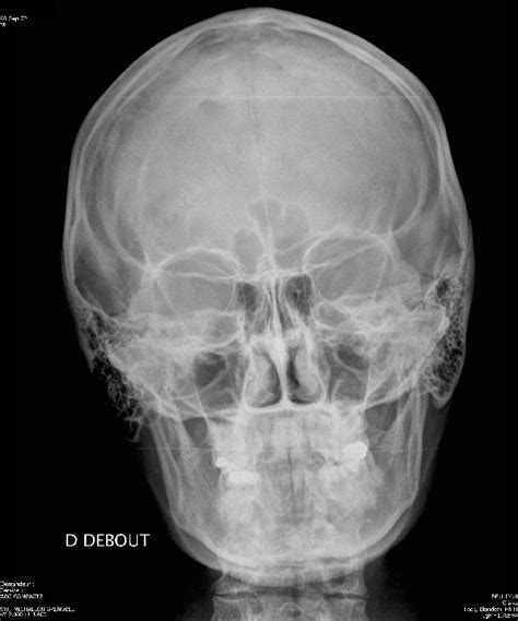 Imagerie M Dicale Et Endoscopie En Premi Re St S Biotechnologies St S