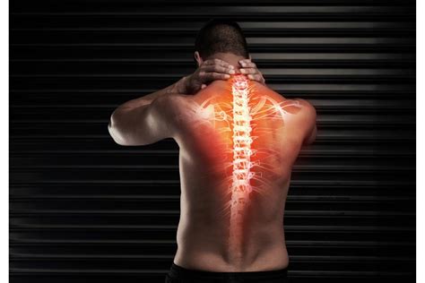 Fracturas vertebrales causas tratamiento y prevención Traumatología