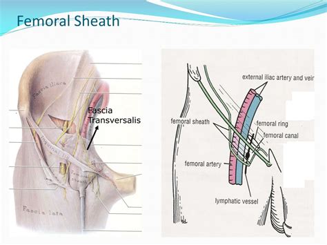 Femoral Sheath