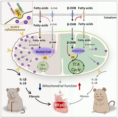 Circulation Research酮体β 羟丁酸靶向调控线粒体 炎症环路减轻HFpEF 知乎