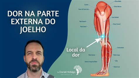 cáustico Nuvem família dor parte interior joelho Enfrentar cor Botânica