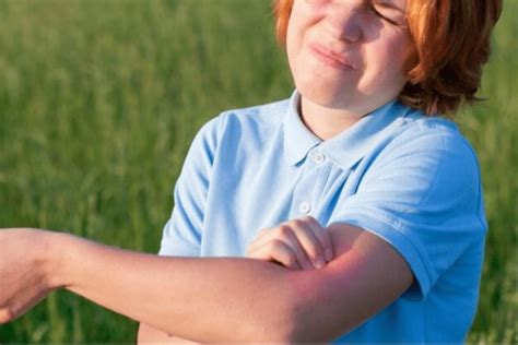Alergias de verão saiba como prevenir e tratar