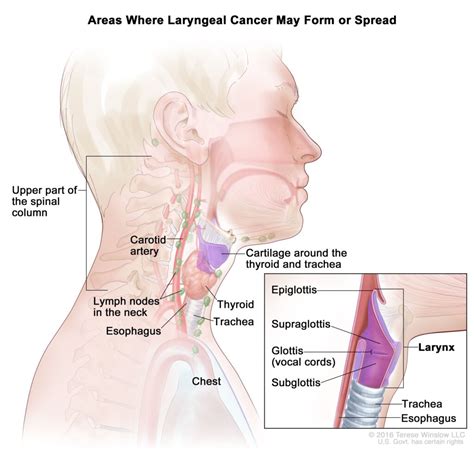 Understanding Larynx Cancer Ask The Nurse Expert