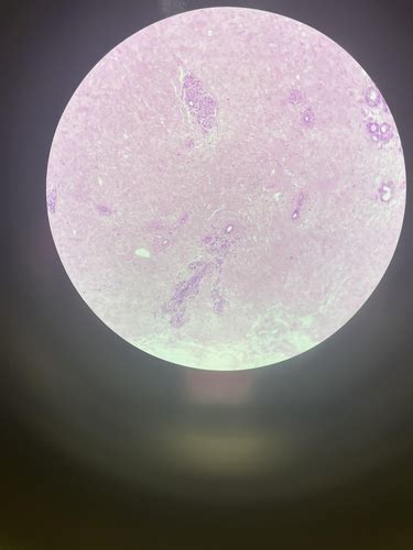Female Reproductive Lab Flashcards Quizlet