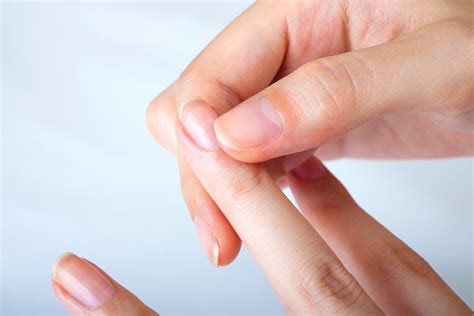 Ongles striés causes traitements prévention
