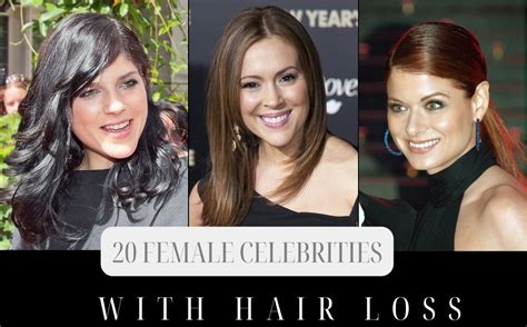 20 Female Celebrities Opened Up About Their Hair Loss