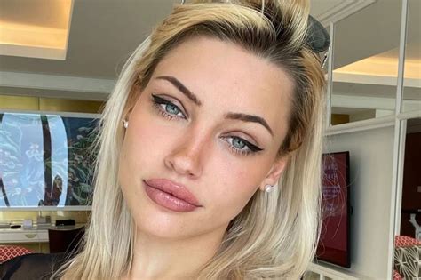 Model Savagely Beaten And Turned Into ‘sex Slave By Sicko Nyc Plastic Surgeon In 10m Lawsuit