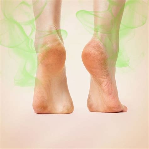 Mal Olor En Los Pies Causas Y Tratamiento Eduliswoman
