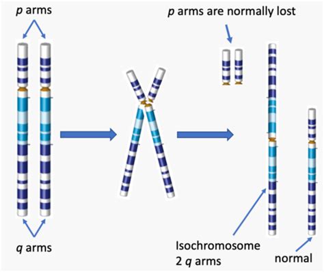 Chromosomal Abnormalities Flashcards Quizlet