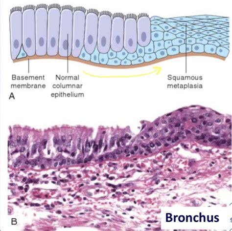 Pathology Exam Flashcards Quizlet