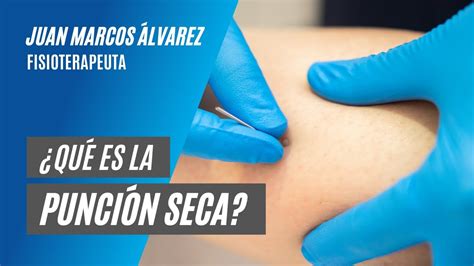 Qué es la punción seca YouTube
